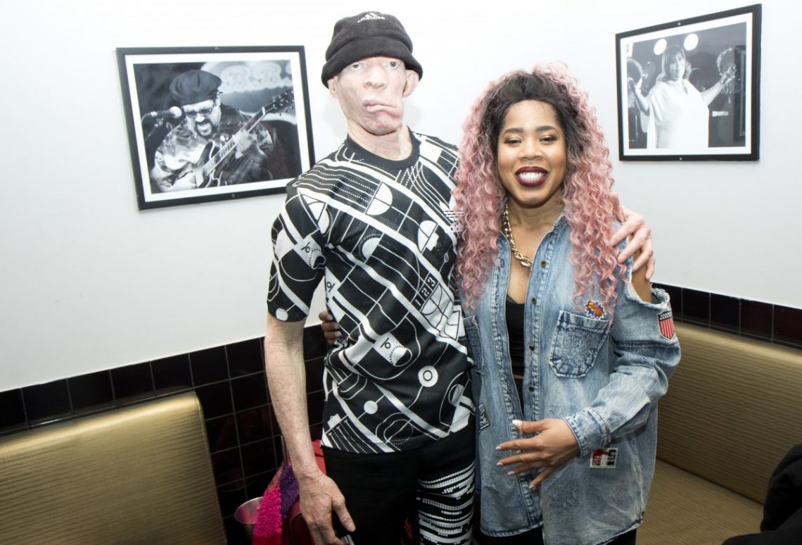 Photo Highlights of King Yellowman at BB Kings - Jamaicans.com